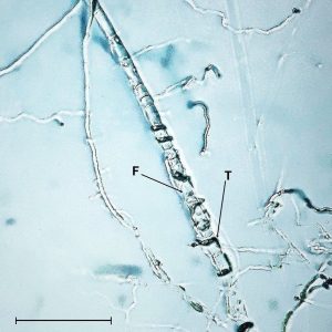 Learning Micro: Exploring the Microscopic World of a Pineapple