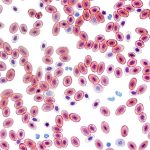 Blood Cells Under Microscope: A Detailed Look at Hematology